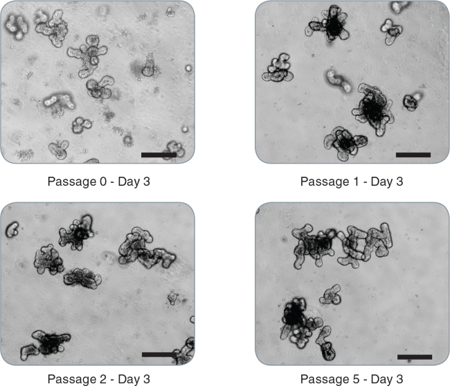 Intestinal Organoid Culture | STEMCELL Technologies Intestinal Organoid Culture | STEMCELL Technologies